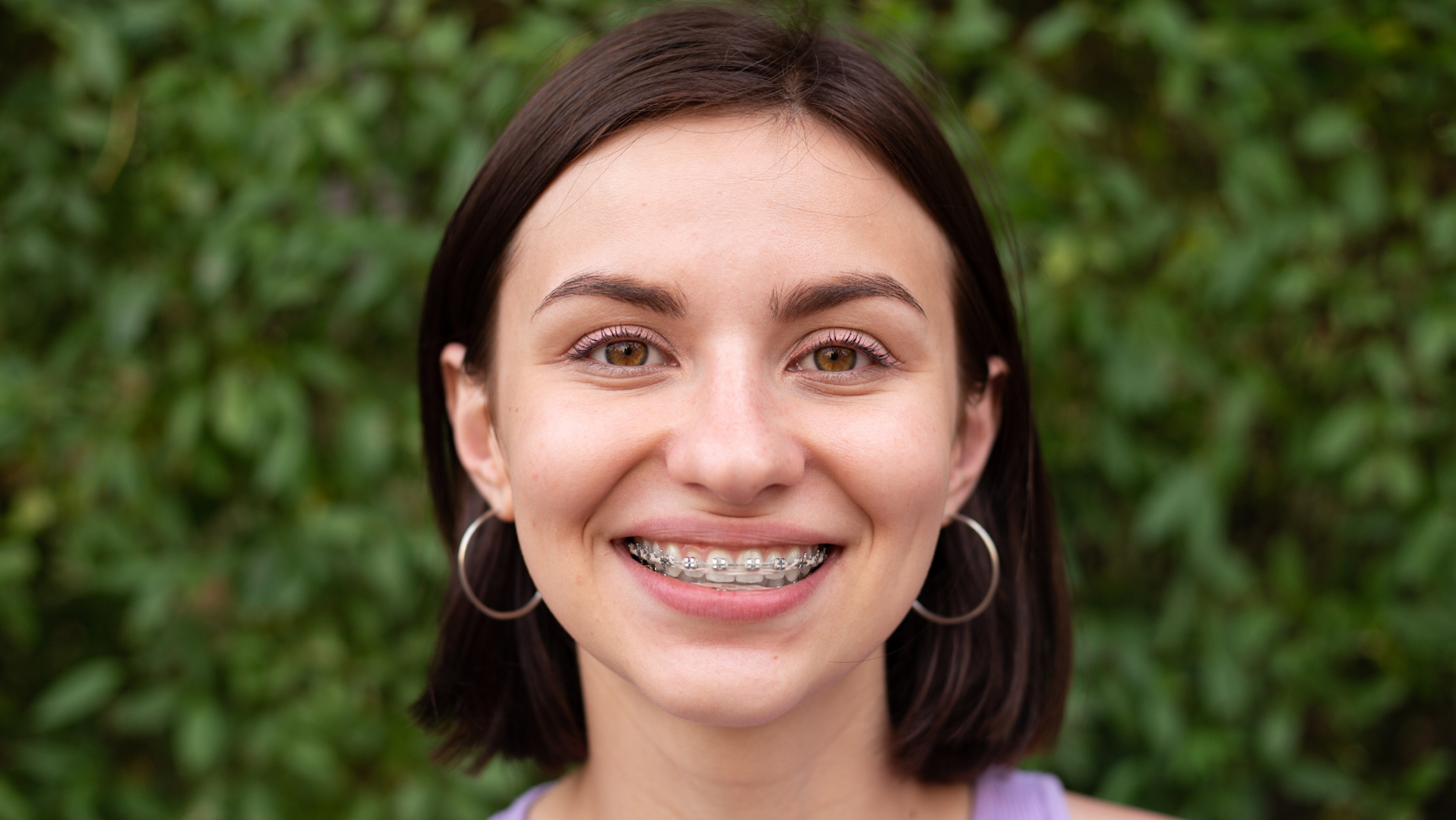 ¿Qué color de frenillos debo ponerme? | Risas Dental and Braces