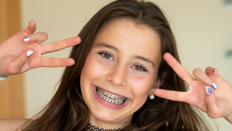 ¿Qué color de frenillos debo ponerme? | Risas Dental and Braces